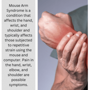 Should Your Wrist and Arm Touch the Mouse Pad?